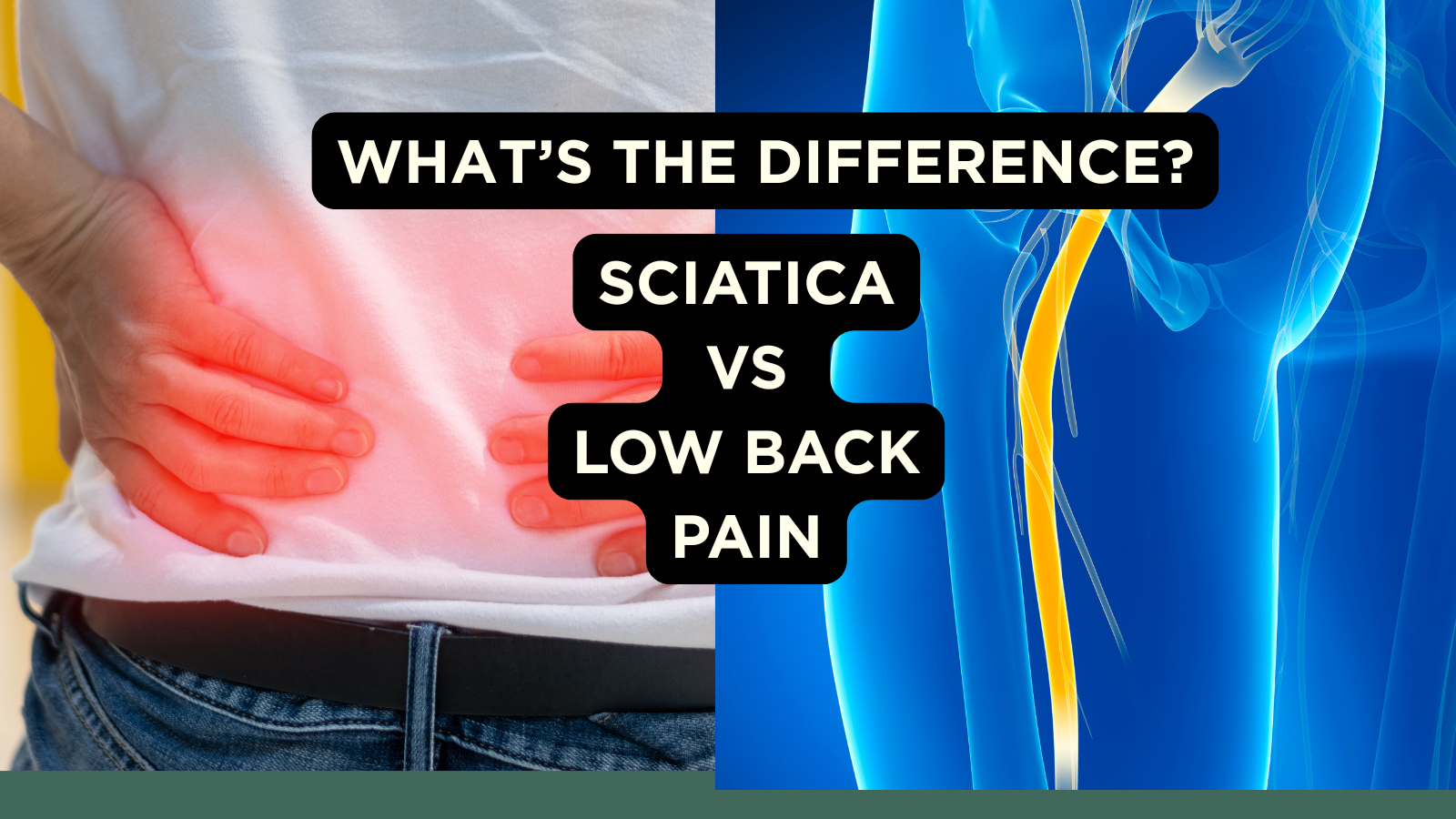 Sciatica vs Low Back Pain: Key Differences Explained